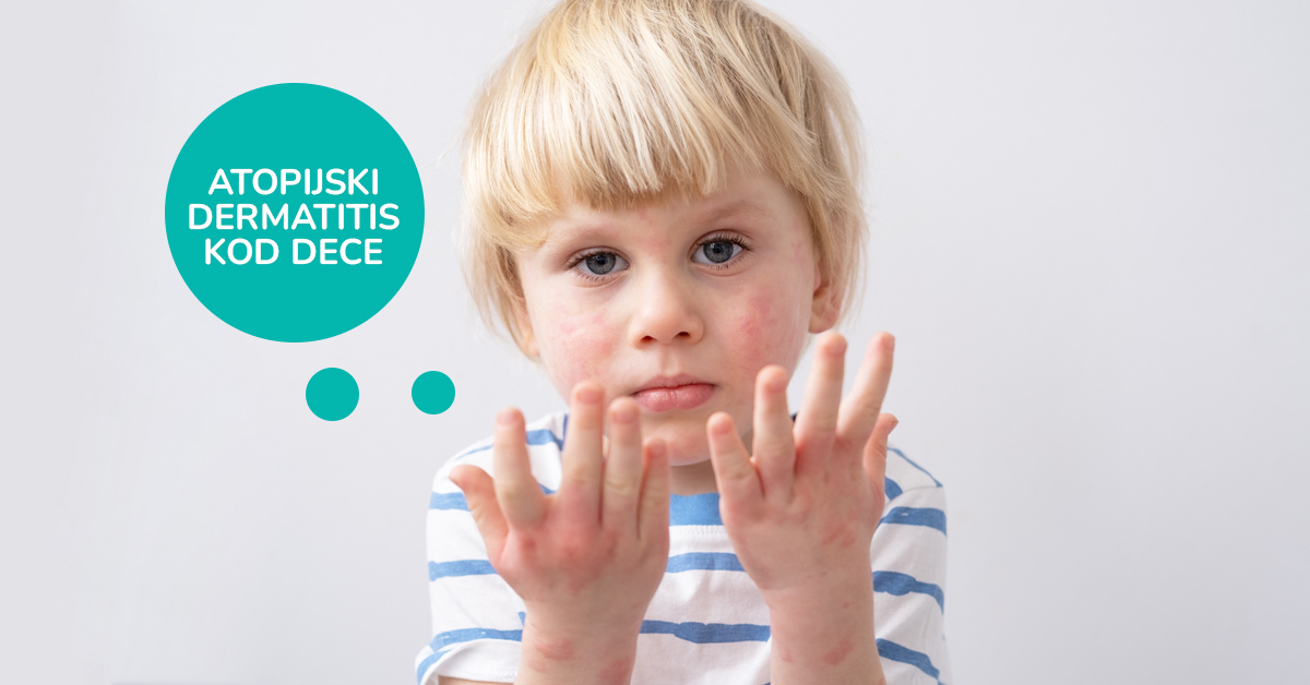Atopijski dermatitis kod dece - Bebicol